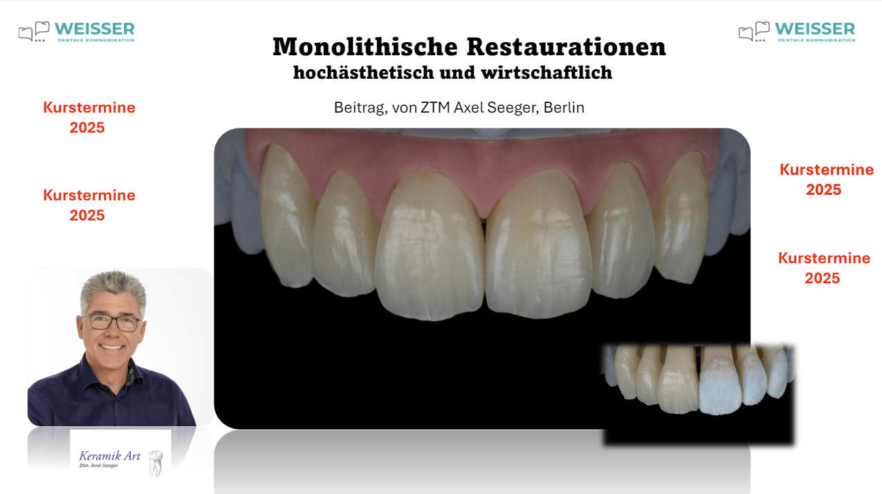Monolithische Restaurationen hochästhetisch und wirtschaftlich - Neue ...